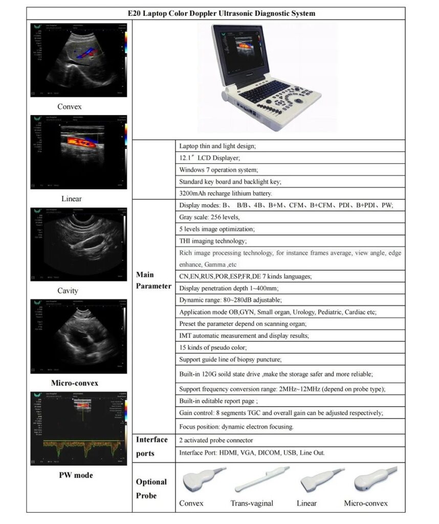 12 Inch LED Screen 3D Notebook Color Doppler Echo Ultrasound Diagnosis ...