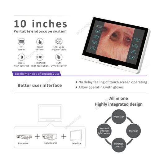 High Quality Flexible Video Cystoscope Cystonephroscope Bladder ...