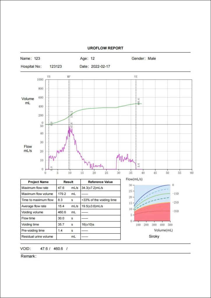 Ideal Urodynamic Equipment Uroflowmetry Urine Measurement